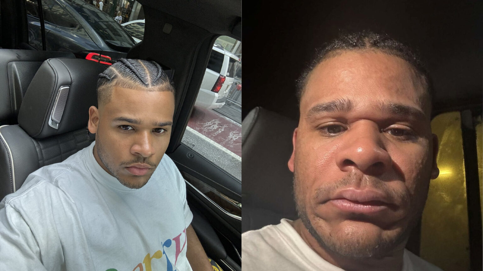 AMP Fanum Suffers Allergic Reaction, Reveals Picture of Himself From ...