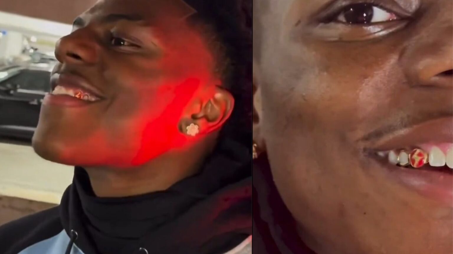 IShowSpeed Shows Off His Brand New Canary Diamond Lightning Bolt Teeth ...